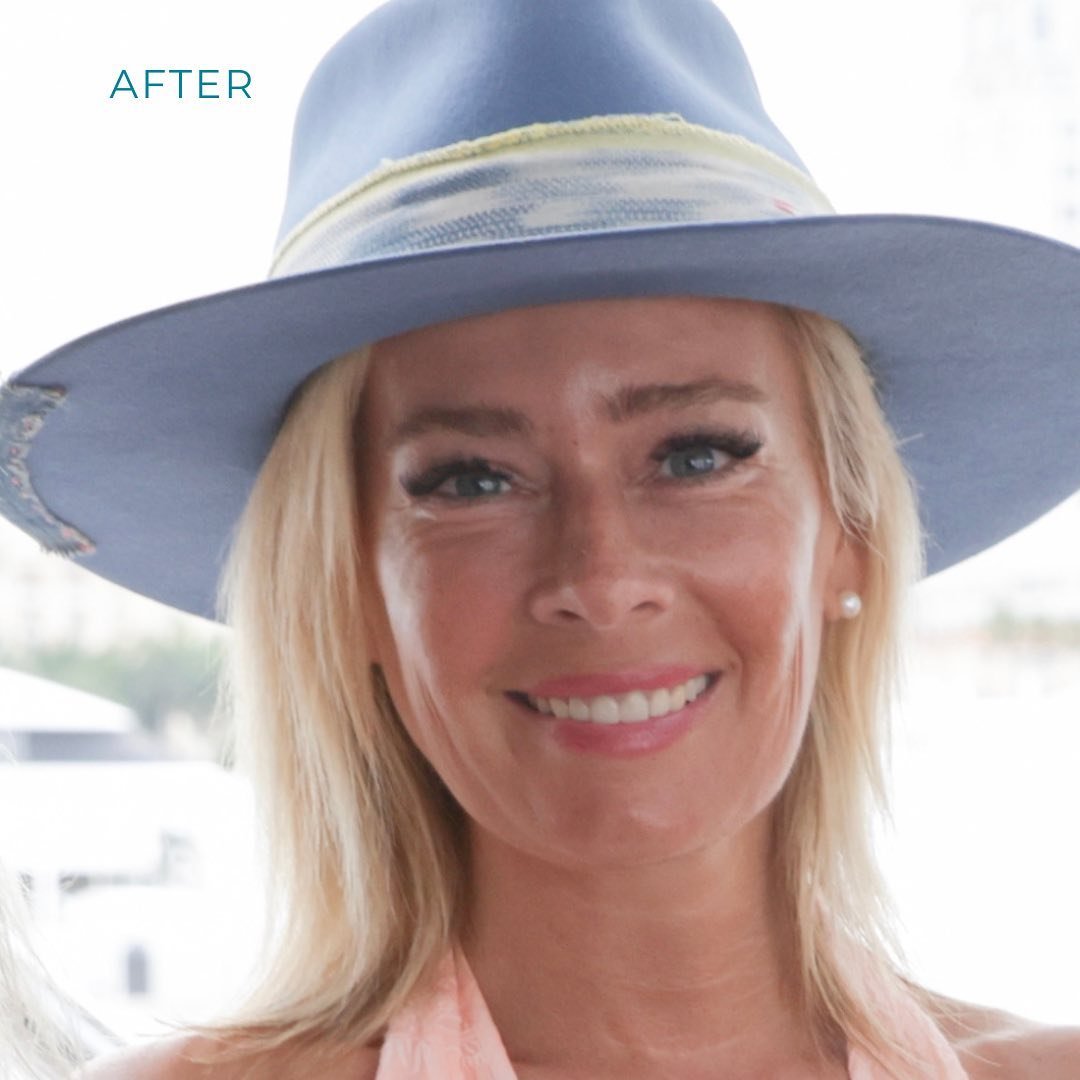 Stacey Leuliette’s Pure Skin Palm Beach Journey: A Testimonial of Trust ...