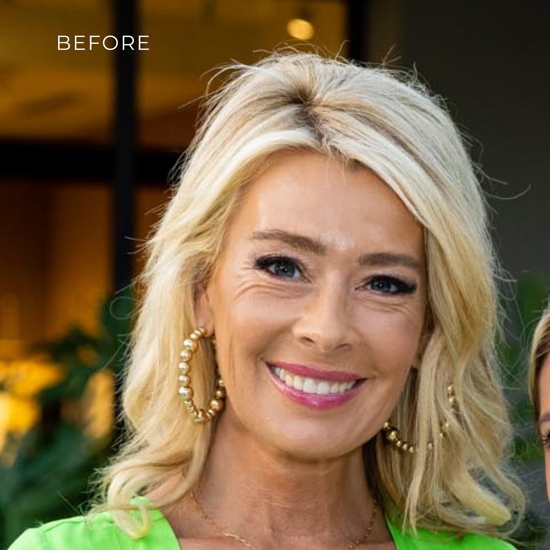 Stacey Leuliette’s Pure Skin Palm Beach Journey: A Testimonial of Trust ...