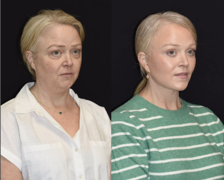 The Art of Timeless Beauty: How Dr. Elizabeth Chance is Redefining ...