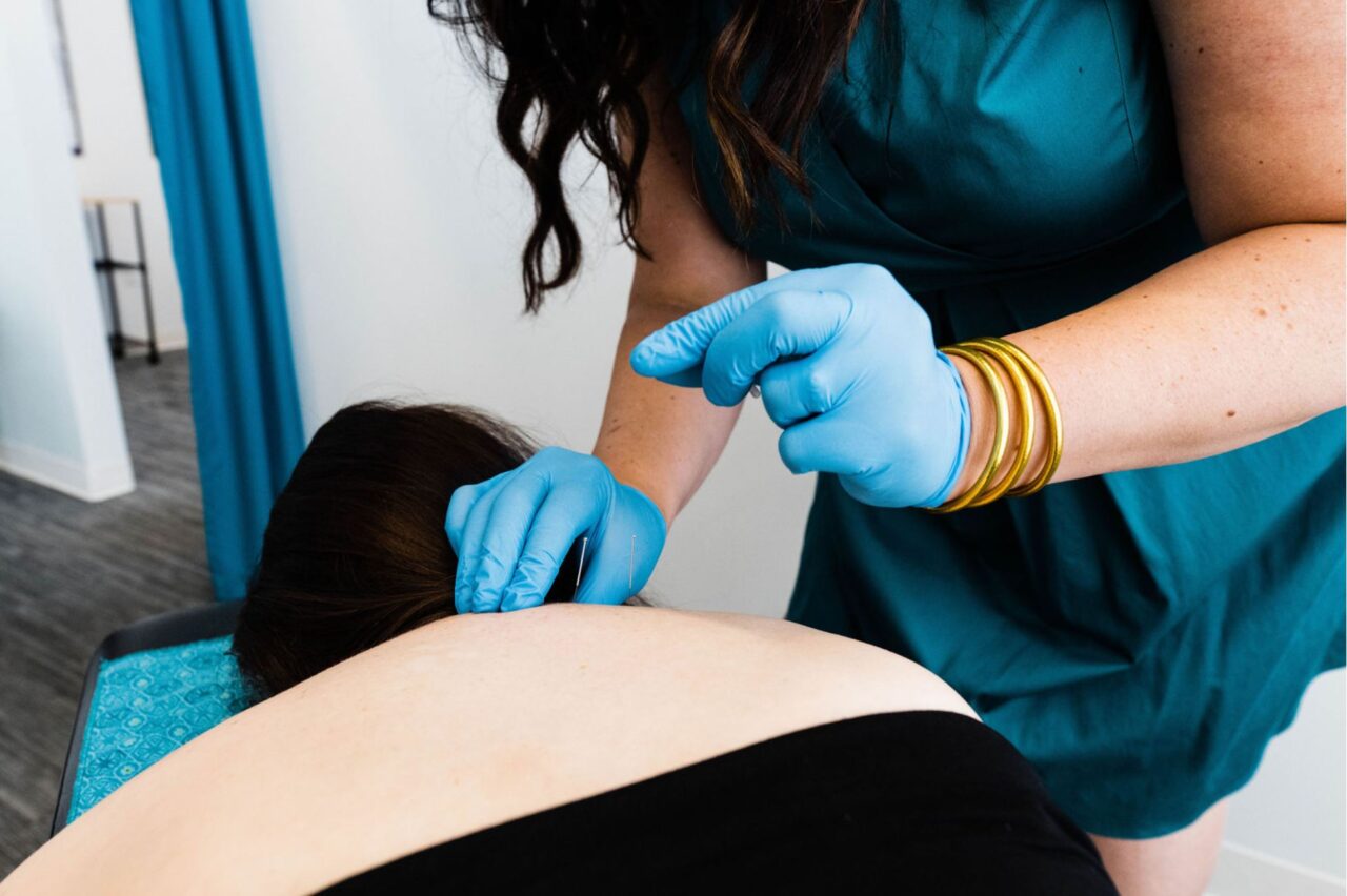 Dry Needling Explained: Benefits and Insights - The Scout Guide