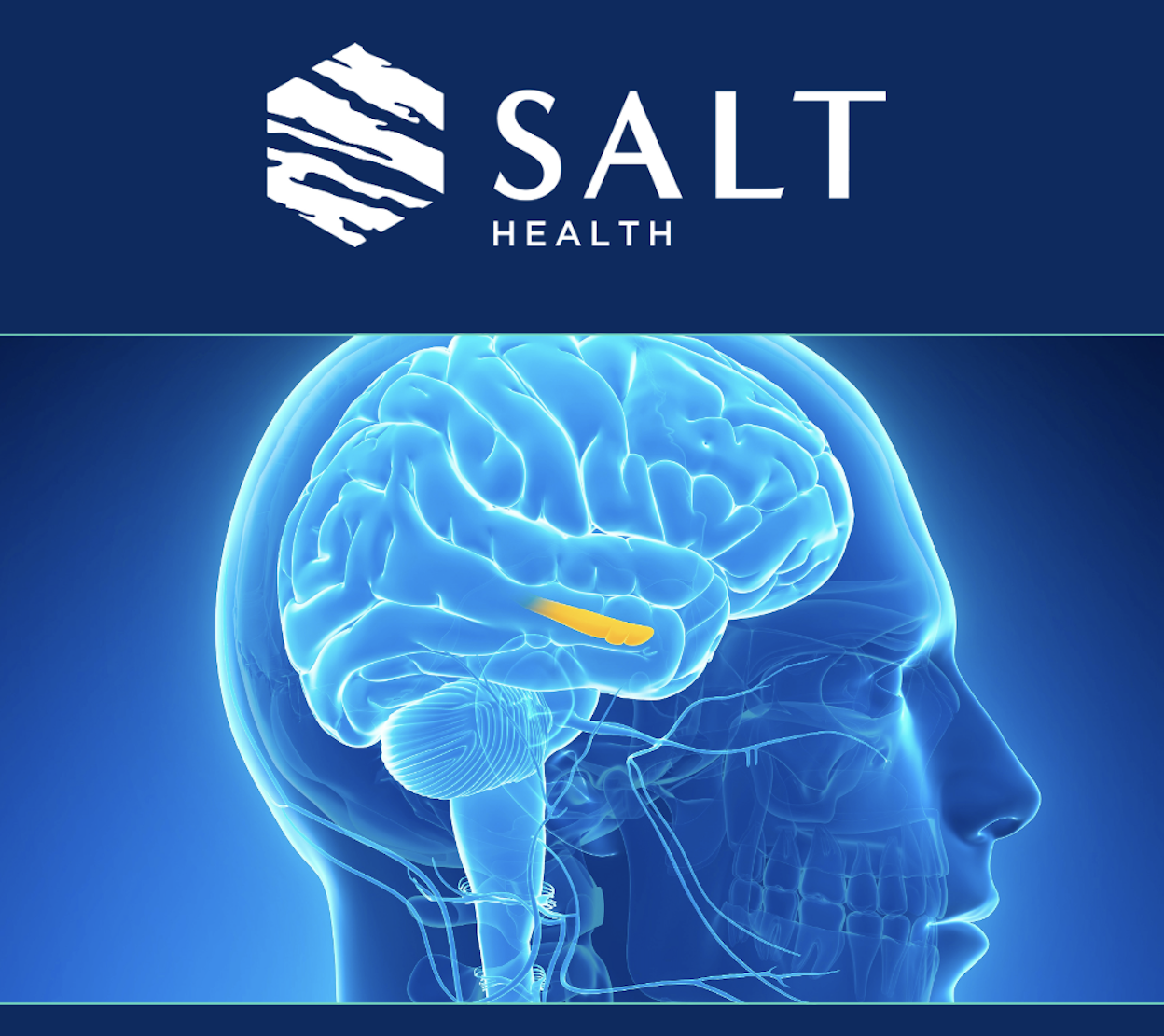 Brain Health Seminar | SALT - The Scout Guide